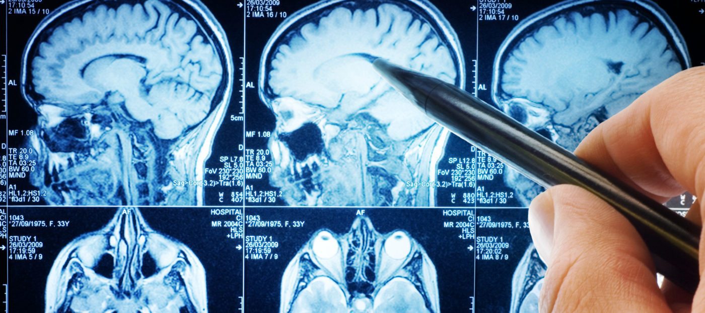 Why Your Database Is The Central Nervous System Of Your Business ...